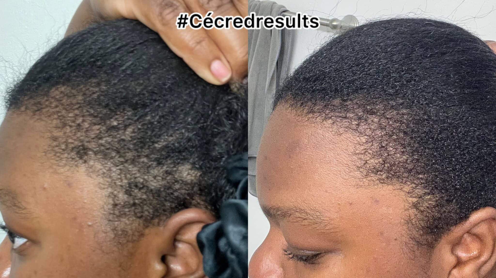 Here's How People Are Using Beyoncé’s Cécred Restoring Hair & Edge ...